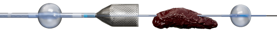 iCHOR: Revolutionizing Thrombectomy with Simplicity